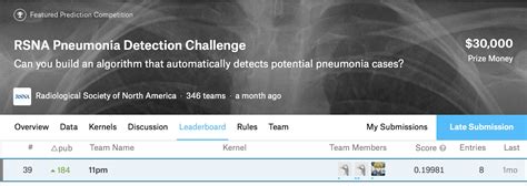 RSNA Pneumonia Detection Challenge Kaggle