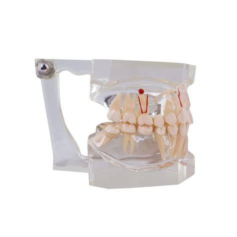 Macromodelo Con Patología Completa