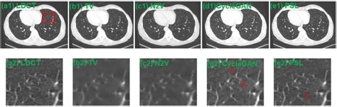 denoising performance comparison among different algorithms for the