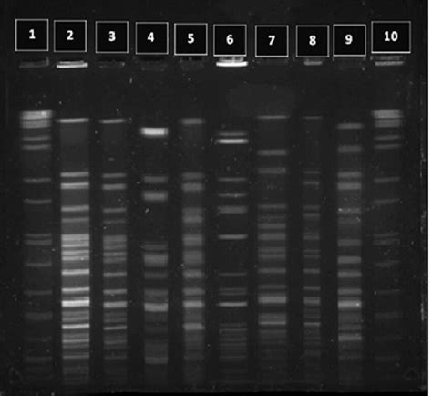 Representative Agarose Gel Showing Pfge Patterns Of Apai Digested
