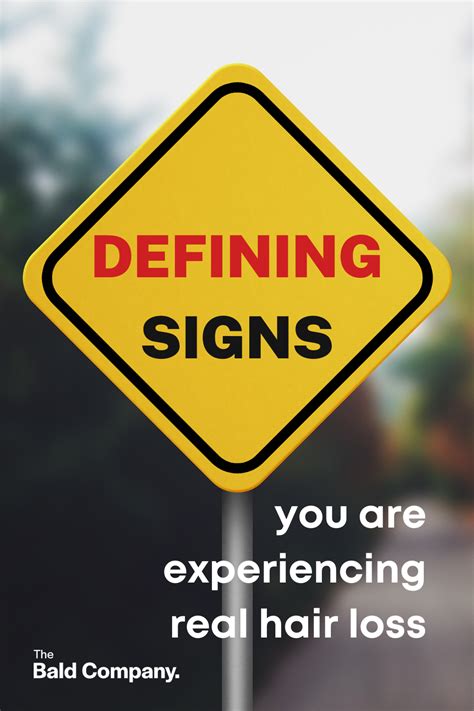 Defining Signs That You Are Going Bald What To Do About It Thebaldcompany Com