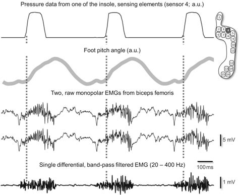 Segmentation Of Running Cycles And Computation Of Differential Emgs