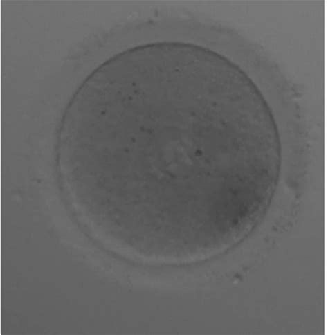 Assessing Oocyte Quality Krishna Ivf Clinic