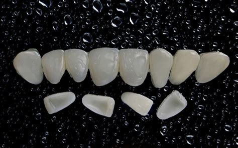 Dental Veneers Uses Types Pros And Cons Expert Advice