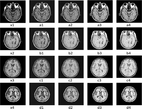 Visual Results Of Different Methods On Mri T1 Images Xi I 1 2 3 Download Scientific