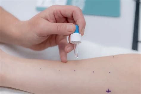 Allergy Test In Vienna Ent Vienna Dr Wimmer