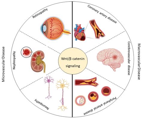 Diabetes Mellitus Type 2 Complications
