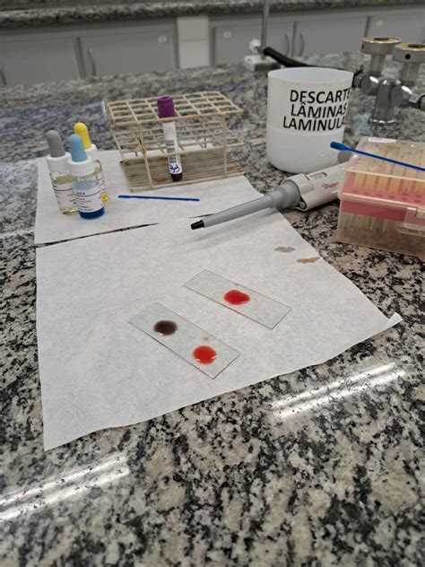 A Tipagem Sanguínea é O Processo De Coleta E Análise De Sangue Do