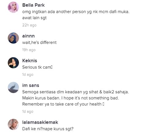 Macam Lain Je Sakit Ke” Video Tiktok Dafi Nampak Kurus Buat Netizen Bimbang Hot Fm