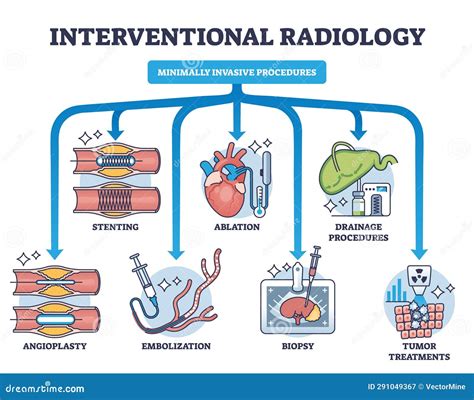 Minimally Invasive Surgery Neon Light Icon Vector Illustration