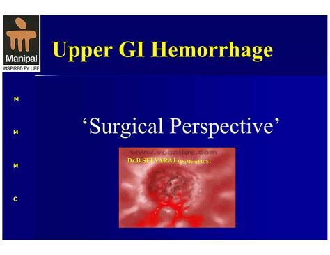 Upper Gi Bleeding Non Variceal Bleeding How To Diagnose And Treat