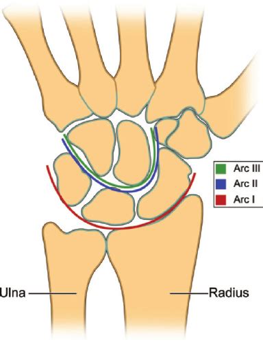 Scaphoid And Lunate Fossa