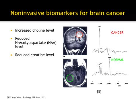 Introduction To Compressed Sensing MRI PDF