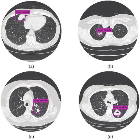 Lung Nodule Testing Results With Big Size A And D Vs Small Size Download Scientific