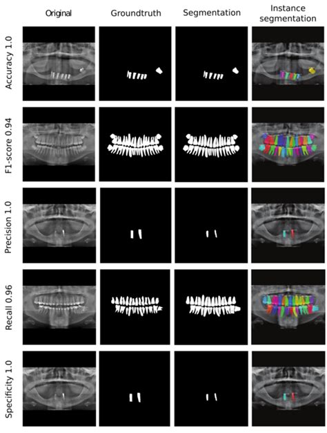 Deep Instance Segmentation Of Teeth In Panoramic X Ray Images