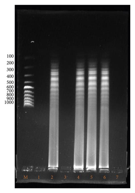 A Effect Of Loop Primers LP On Sensitivity And Incubation Duration Download Scientific