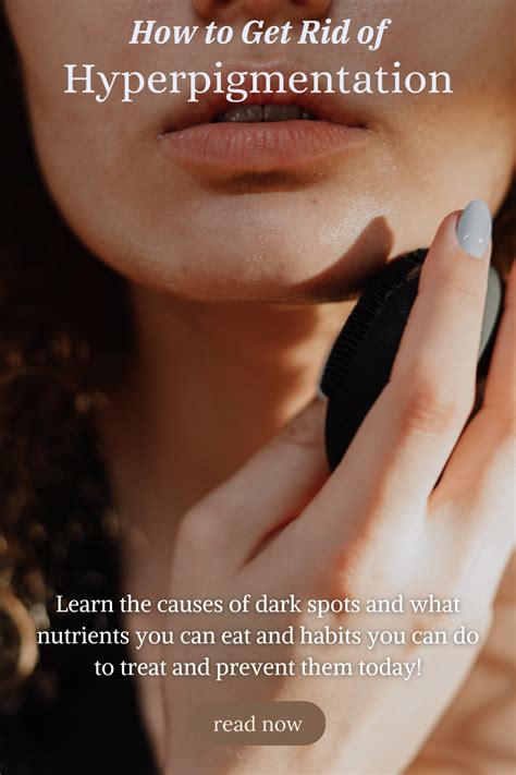 How To Get Rid Of Hyperpigmentation And Dark Spots Easily Artofit