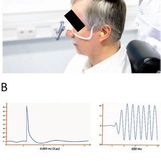 TPS Neuromodulation In Ten Healthy Subjects A Transcranial Pulse Download Scientific Diagram