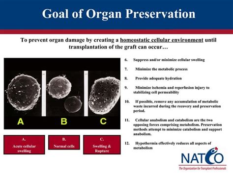 Organ Recovery And Preservation