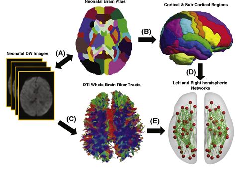 Figure 1 From Structural Connectivity Asymmetry In The Neonatal Brain