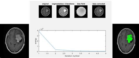Input Bias Corrected And Segmentation Results For A Sample Image B Download Scientific