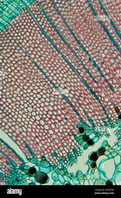 Light Micrograph Of A Transverse Section Through A Yew Tree Taxus Sp