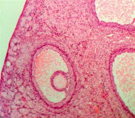 Ovary Diagram Quizlet Ovary Diagram Quizlet