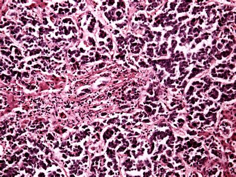 Automating Tissue Dissection Key To Personalized Medicine Medical