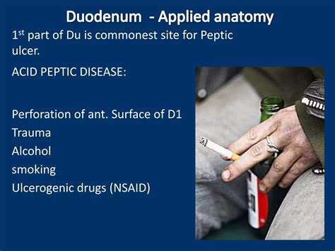 Anatomy Of Duodenum Duodenum Structure Ppt Of Duodenum Power Point Presentation Duodenum Pptx