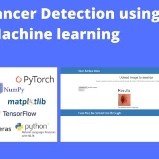 Skin Cancer Detection Using Machine Learning Projectworlds