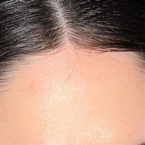 Antoinette On Instagram Scar Makeup For Some Halloween Inspo 🫶🏼 To Me