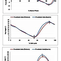 Comparison Between The Suction And Pin Lock Systems For Prosthetic Limb