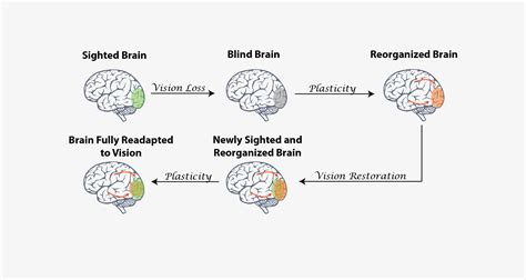 Retinal Prostheses Behavior And Neuroimaging — Stiles Psychophysics Laboratory