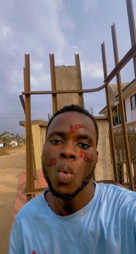 bch412 wilson s disease