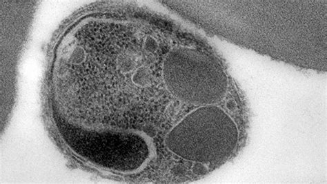 Two Pronged Approach