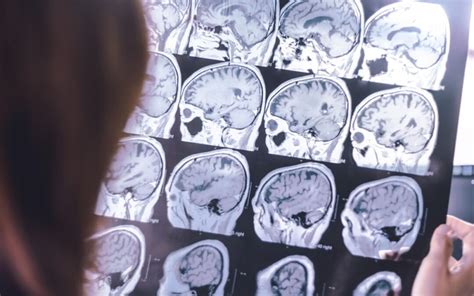 Cómo Se Forman Los Recuerdos Y Dónde Se Almacenan Psicoterapia