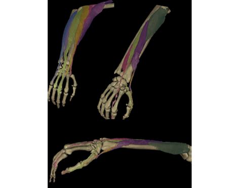 Forearm Extensor Muscles Quiz