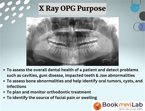 Panoramic Dental X Ray Quezon City At Rafael Gilliam Blog