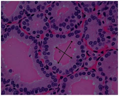 The Major Axis A Is Perpendicular To Minor Axis B Download Scientific Diagram