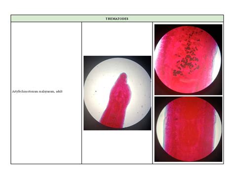 Trematodes [table] Microscope Pictures Medical Laboratory Science