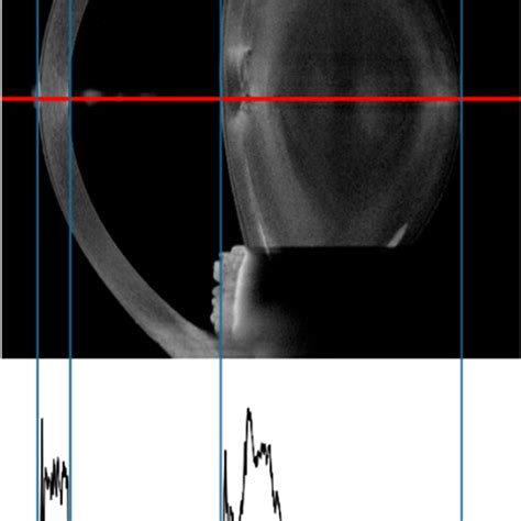 Linear Density Analysis Using Ss Oct The Graph Represents The