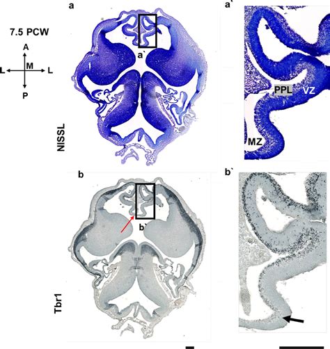 Development Of The Medial Interhemispheric Cortex Revealed By Nissl