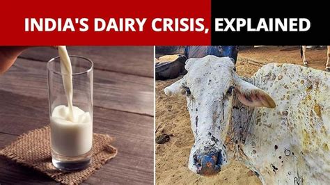 Man Gets Full Face Transplant India Today