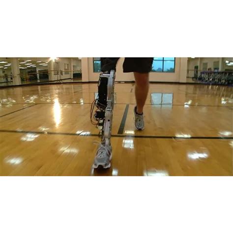 Above Knee Prosthesis Leg At 10000000 Inr In New Delhi Gals