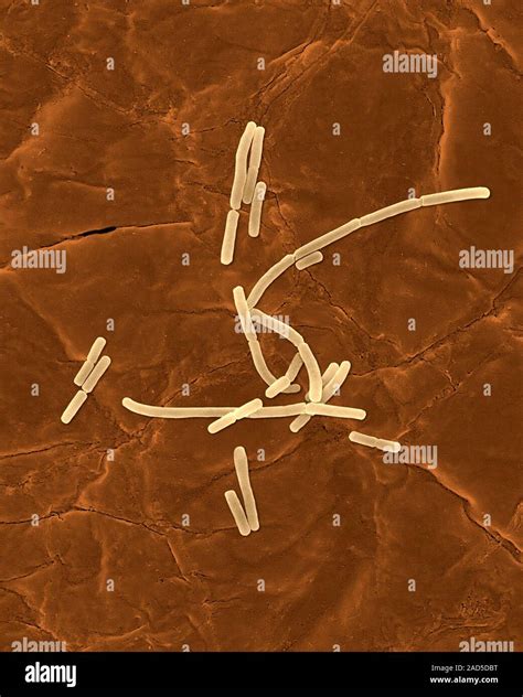 Coloured Scanning Electron Micrograph Sem Of Bacillus Anthracis Vegetative Stage