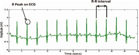 R R Interval Calculations From Ecg Unless Cc License In Place See Download Scientific R R Interval Calculations From Ecg Unless Cc License In Place See Download Scientific