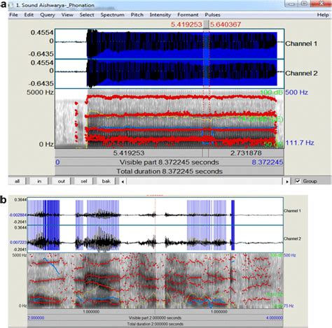 A Normal Signal Spectrogram Obtained From Praat Software B Abnormal