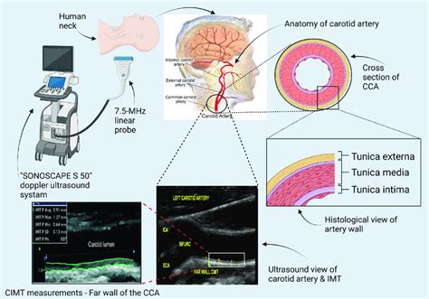 Anatomical Histological And Ultrasound View Of Carotid Artery Segments