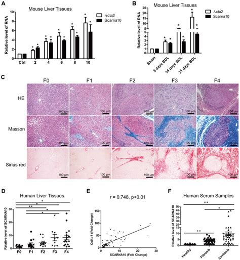 Scarna10 A Nuclear Retained Long Non Coding Rna Promotes Liver Fibrosis And Serves As A