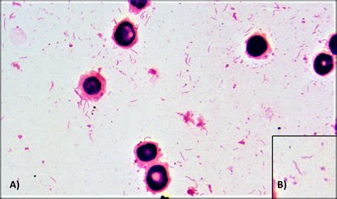 Gram Negative Bacilli